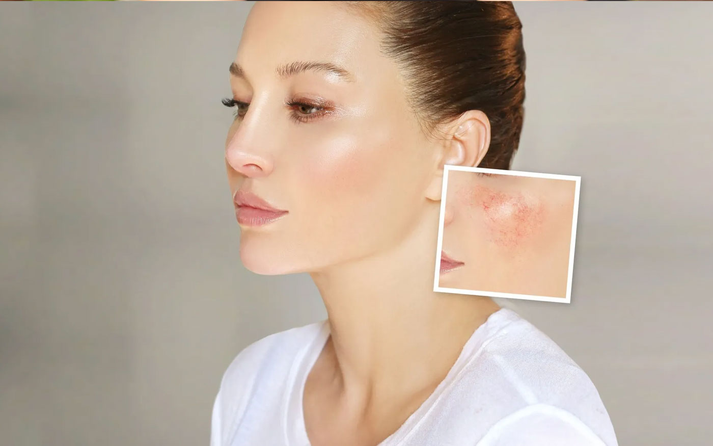 Systemic Lupus Erythematosus - Arizona Arthritis & Rheumatology ...